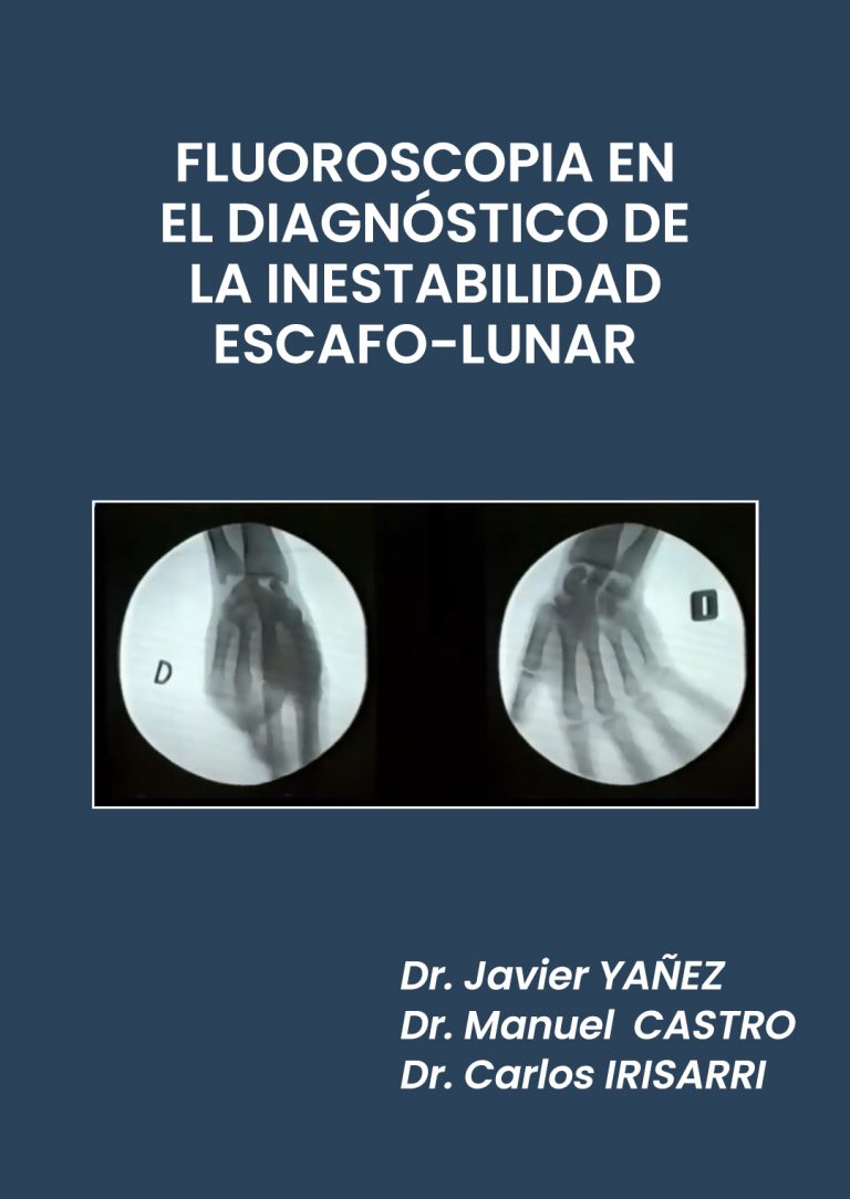Fluoroscopia en el diagnóstico de la inestabilidad escafo-Lunar - GRUPO ...